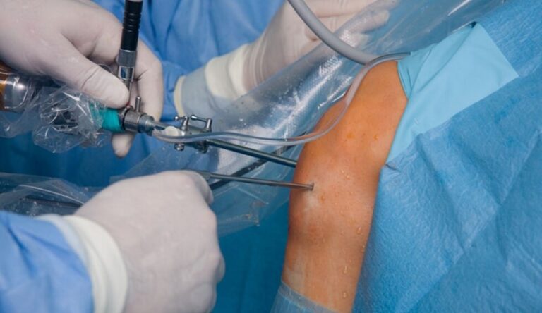 Latest Minimally Invasive Surgery Options in Orthopaedics | North ... Latest Minimally Invasive Surgery Options in Orthopaedics | North ...